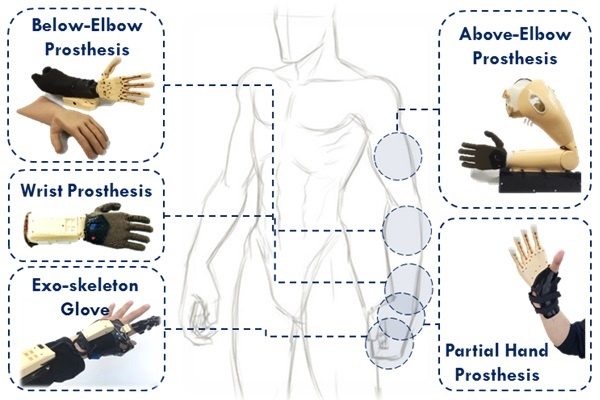 [CES 2021 GCA] Mand.ro to introduce affordable prosthetic hands that ...