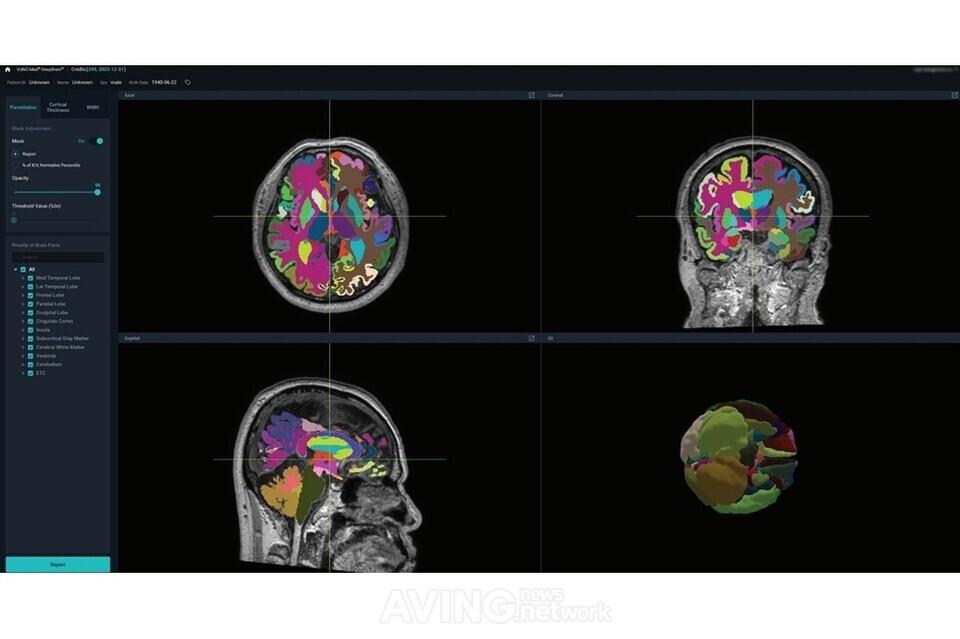 Vuno will officially launch 'VunoMed DeepBrain®' in the US at AAIC 2024 ...