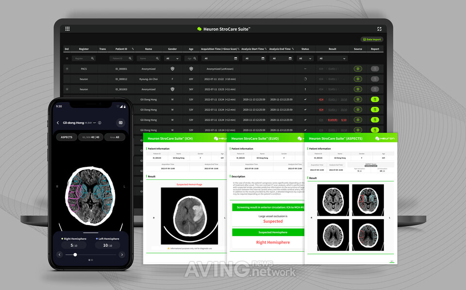 Heuron to Showcase ‘Heuron StroCare Suite™’ Stroke Screening Solution at SWITCH 2024 ...