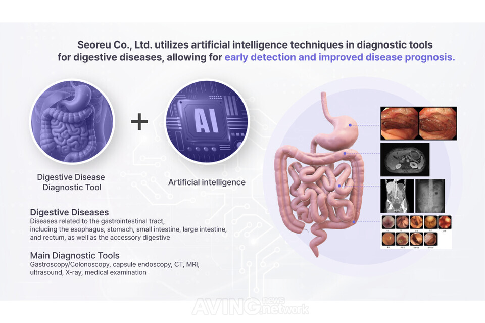 Seoreu to Showcase Capsule Endoscopy AI System ‘CAPTOS’ at CES 2025 ...