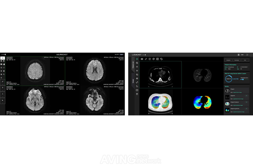 Biolink showcases two AI-powered prediction diagnostic solutions for ...